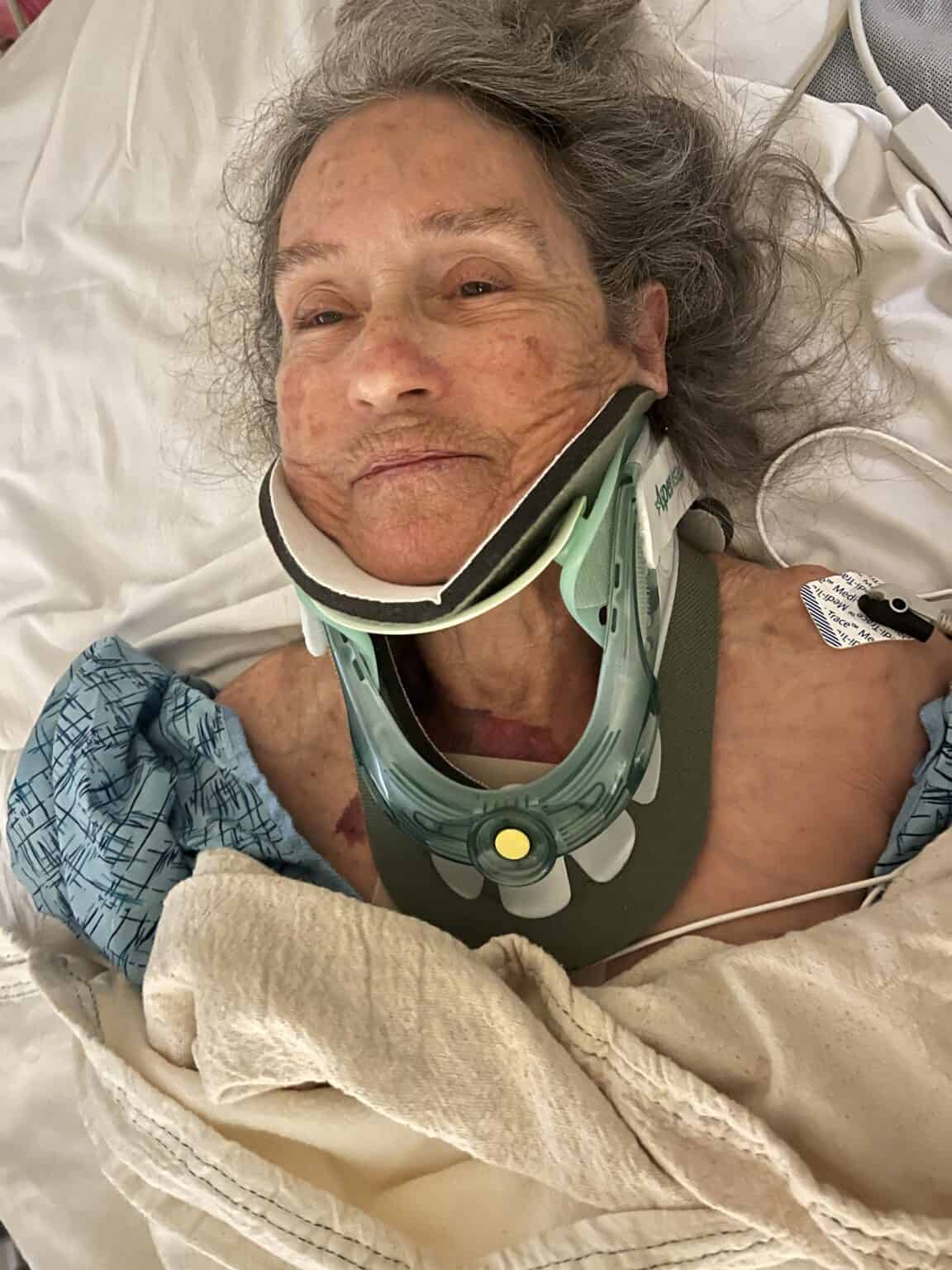 Joan's injuries 2025 - Joan Price